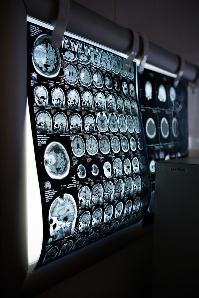 Digital Tools Transforming Dementia Diagnosis | Socialnomics